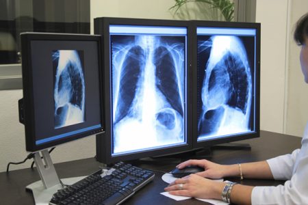 Top 50 Radiology Technology Companies to Watch